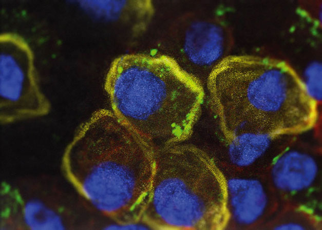 Introducing iLite® Assay Ready Cells for IL-2 and IL-6